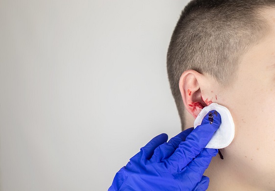 Ear Bleeding: Causes and Treatment | Boots Hearingcare