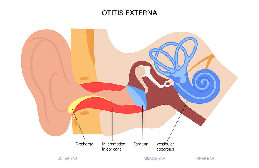 Ear Health: Guide to Common Diseases | Boots Hearingcare