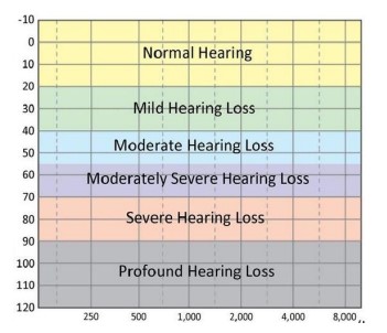 Audiometria: definizione e procedura | AudioNova